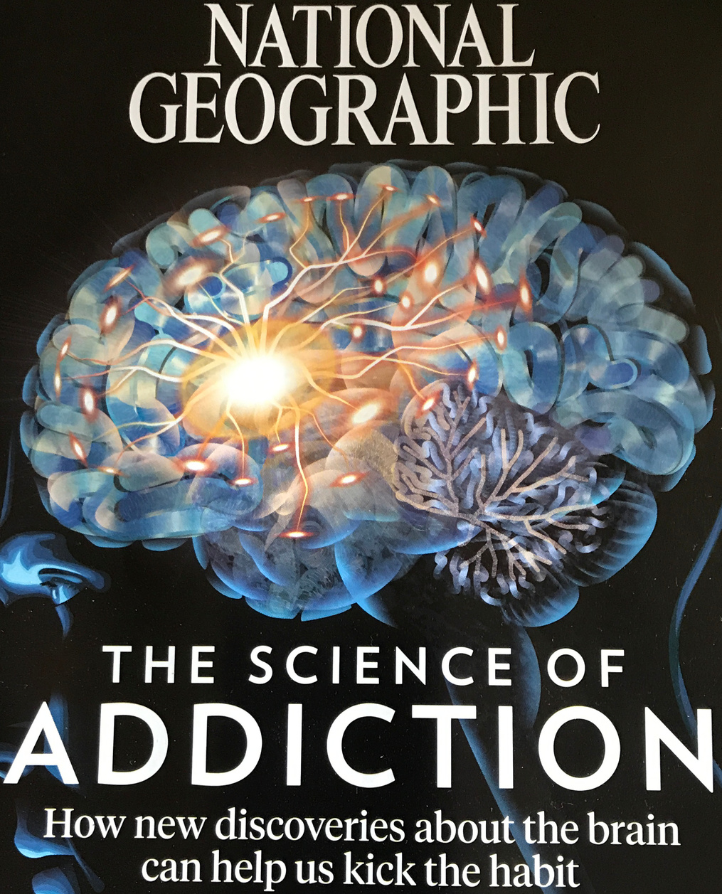 The Science of Addiction - PACE Recovery Center